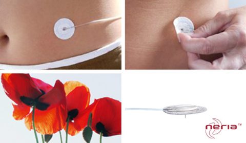 neria ™ Infusion set | Intrapump